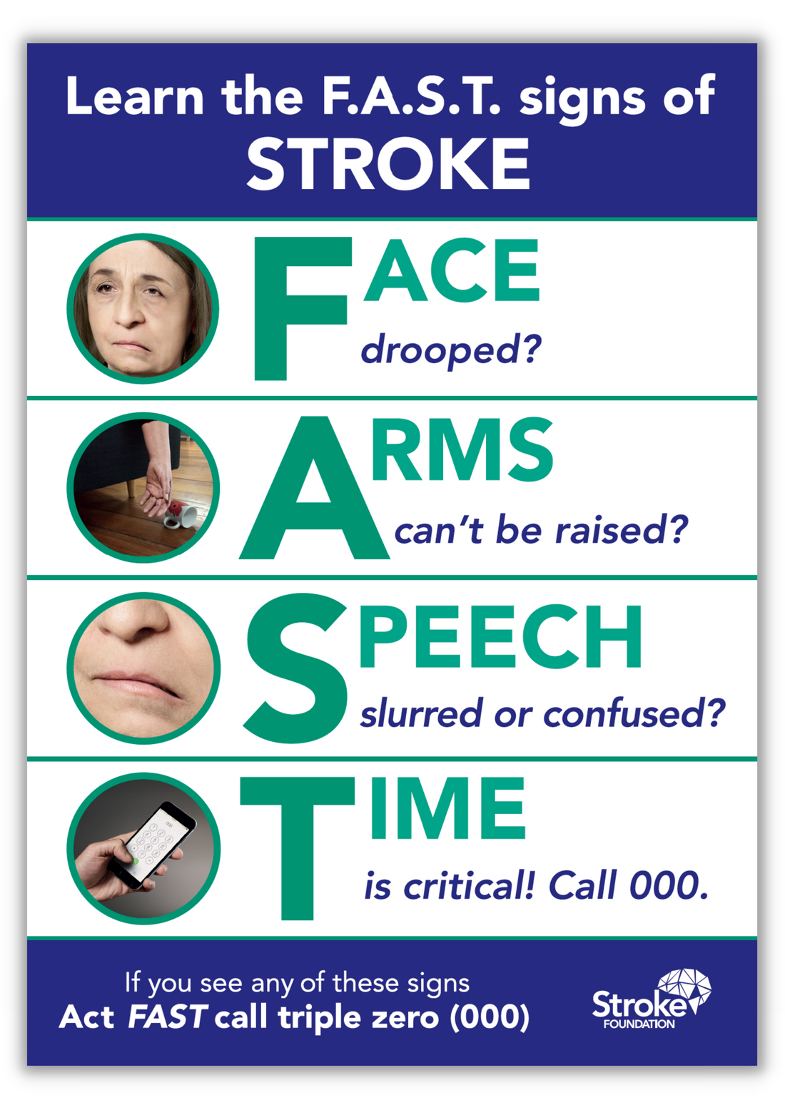 F.A.S.T. poster (A4 size) - Image version – Stroke Foundation Store
